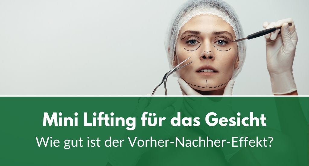 Mini Lifting für das Gesicht: Wie gut ist der Vorher-Nachher-Effekt?